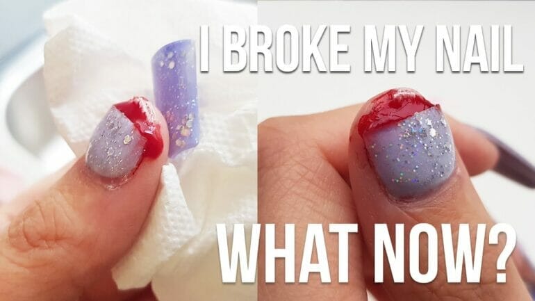 How To Fix A Broken Acrylic Nail Bleeding ? | CraftersMag